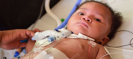 Children’s Healthcare of Atlanta Places 3D-Printed Tracheal Splint in ...